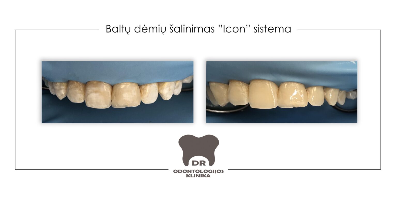 Paslaugos – DR odontologijos klinika